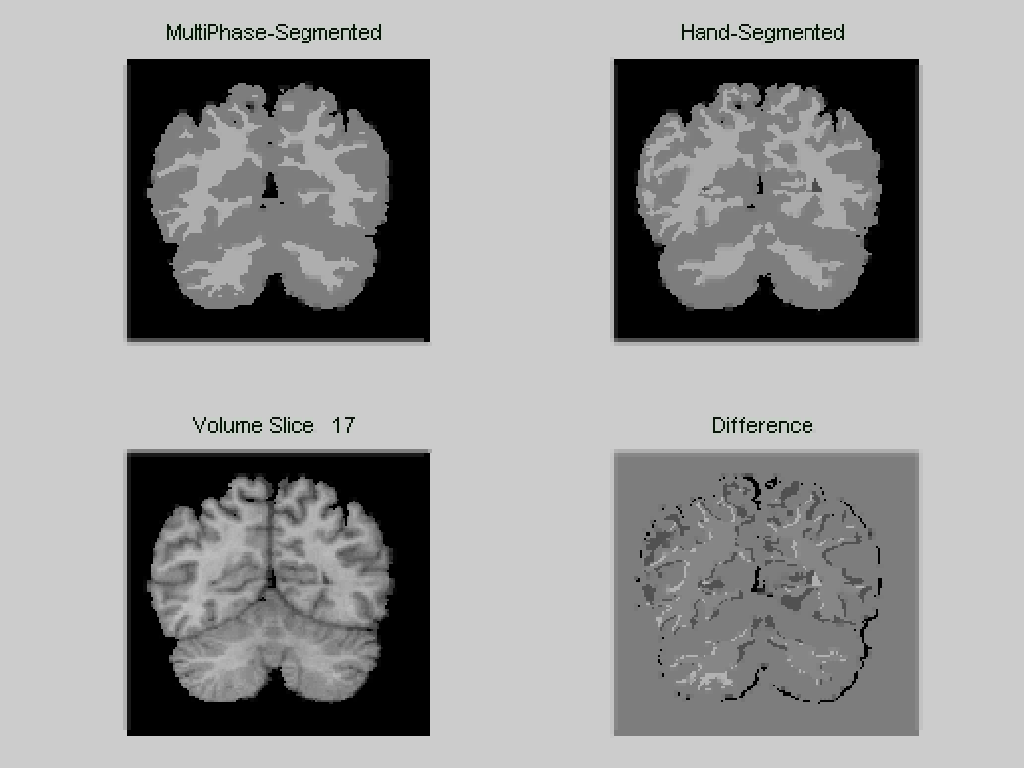 Medical Imaging